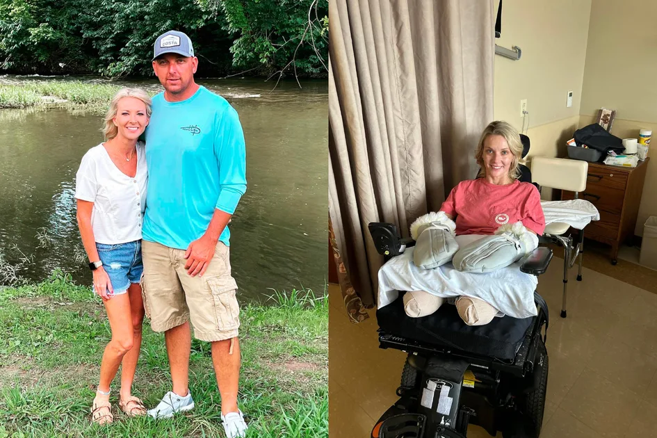 Kidney stones stole my limbs