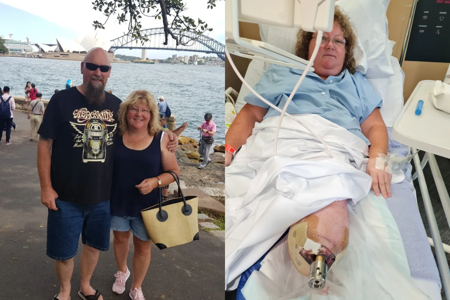 Aussie shock: My pet lamb took my limbs