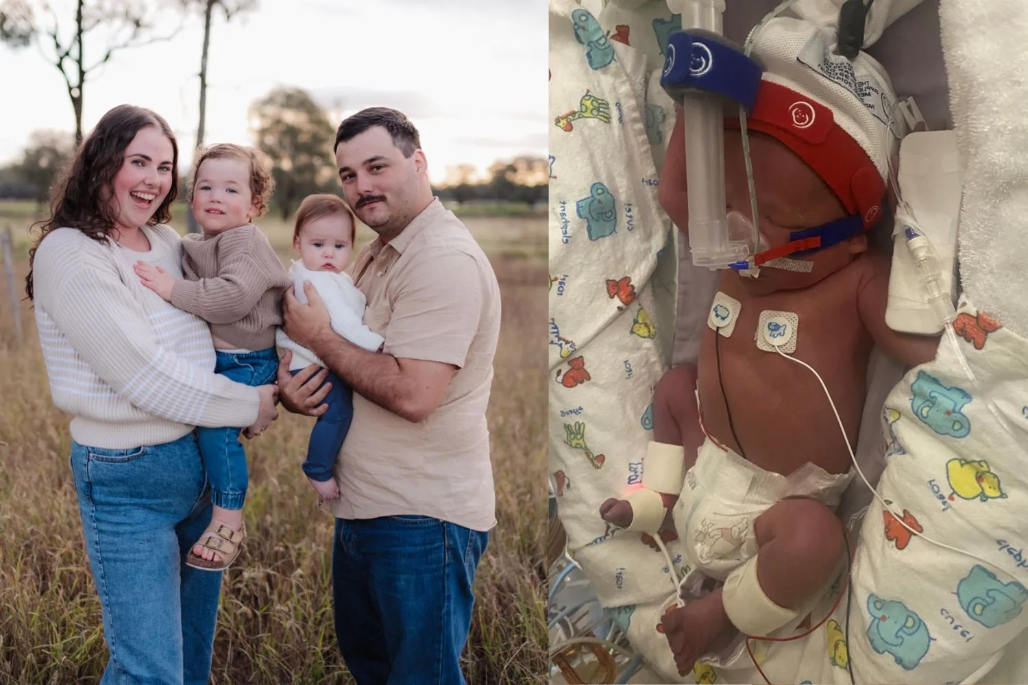 Courageous Koa: My premature baby was born with a tumour