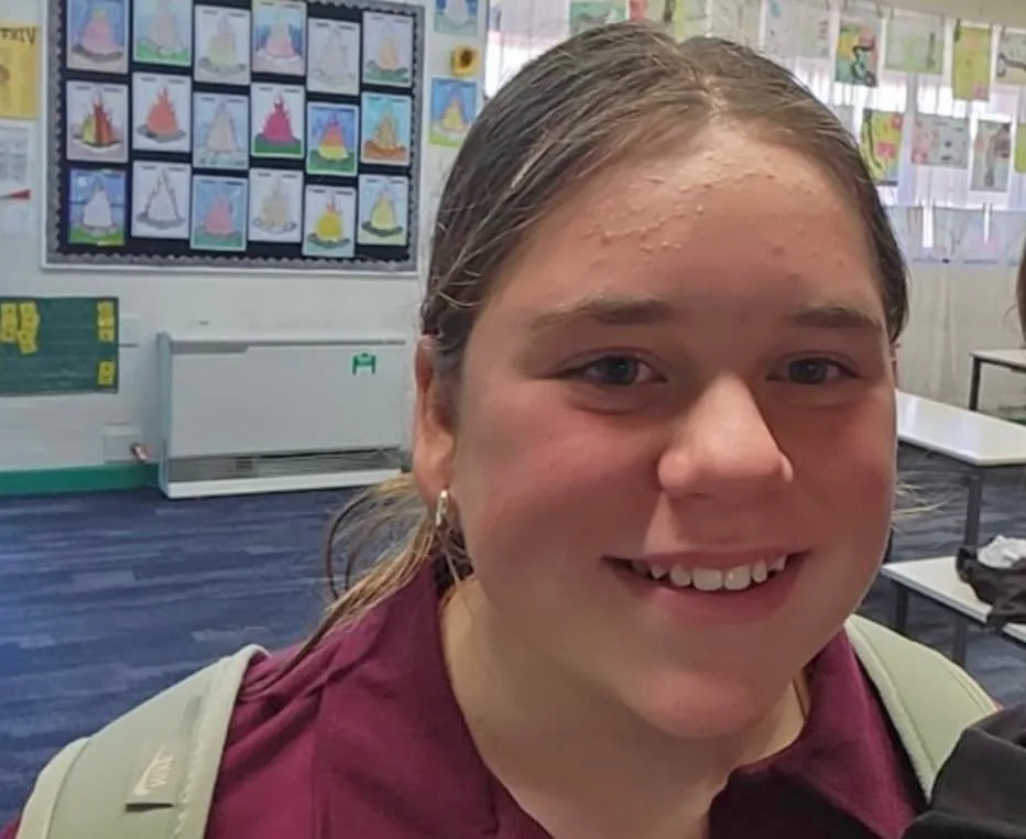 12-year-old girl blinded by a magpie as she walked to school