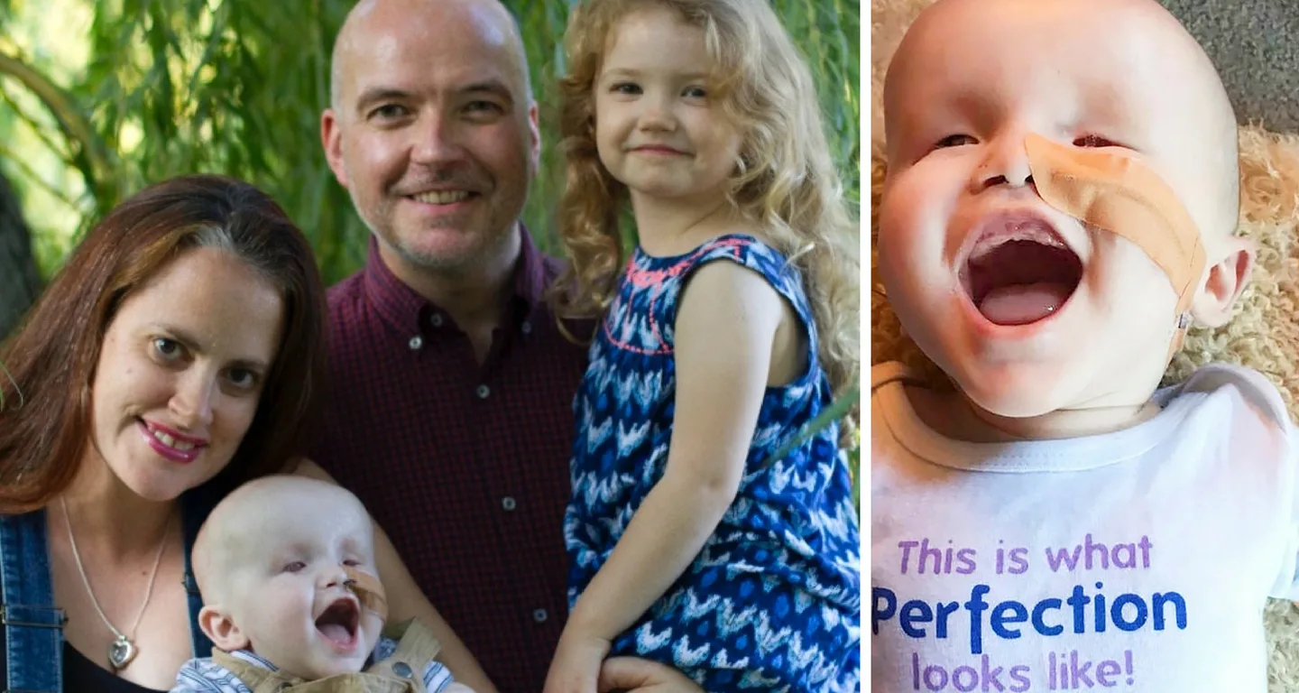 My baby was born without eyes | that's life!