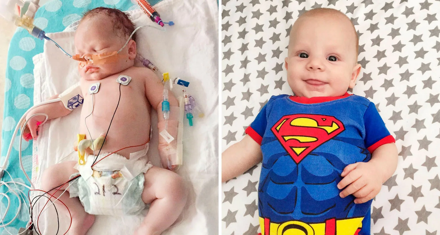 Newborn baby born with congenital fibrosarcoma cancer | that's life!