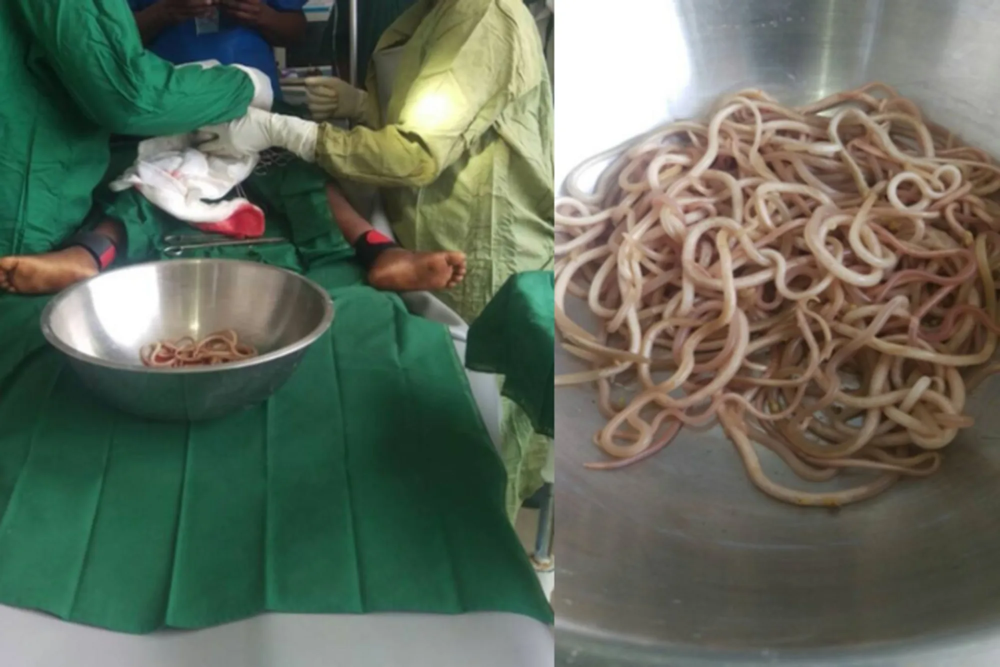 Complaining of a sore tummy surgeons were shocked to find hundreds of ...