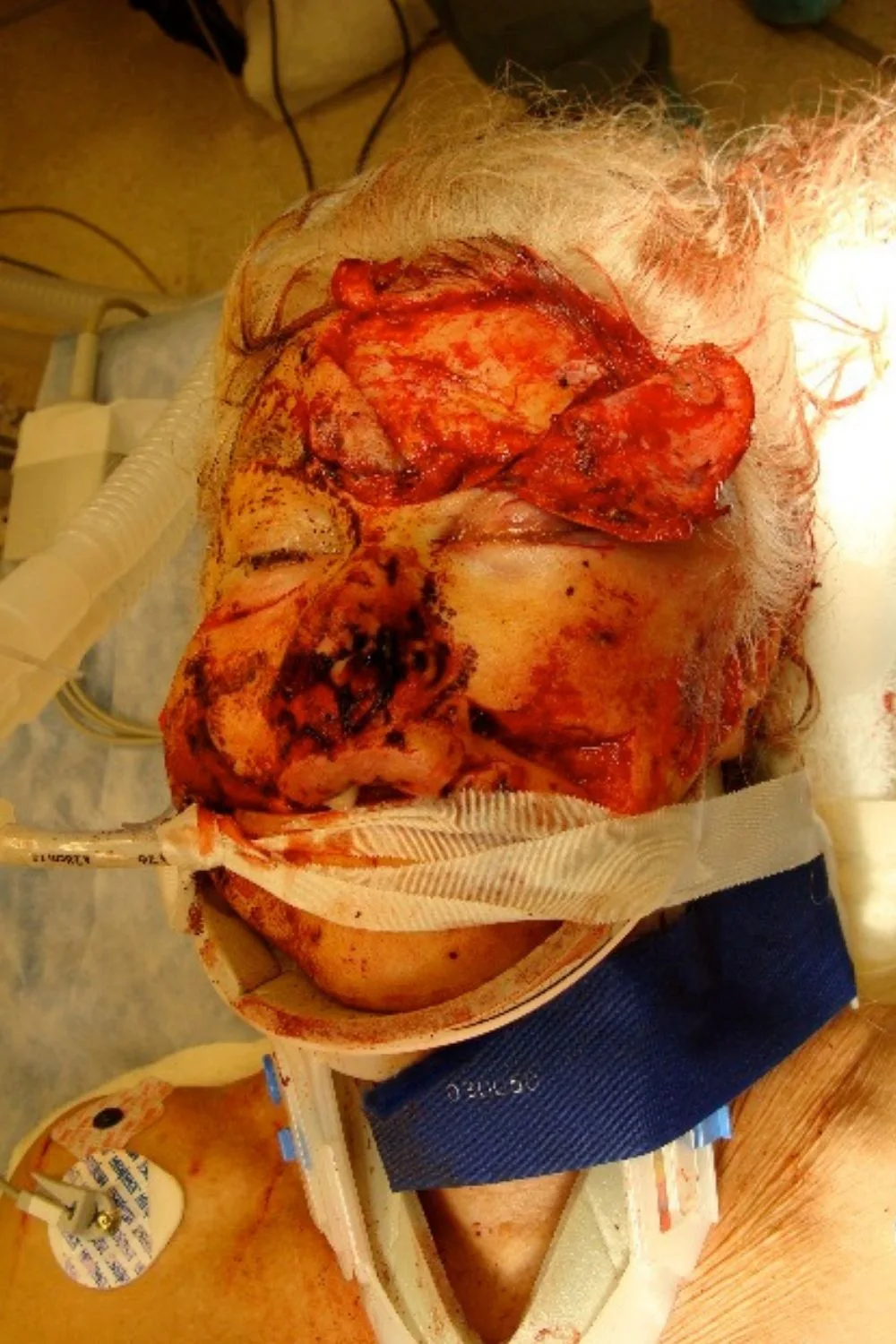 Allena Hansen explains how she survived a black bear attack | that's life!