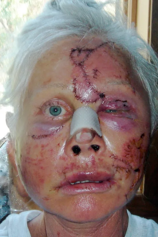 Allena Hansen explains how she survived a black bear attack | that's life!