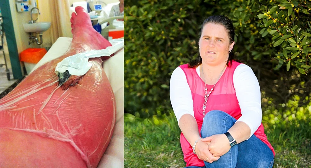 I walked 10km then my leg exploded! | that's life!