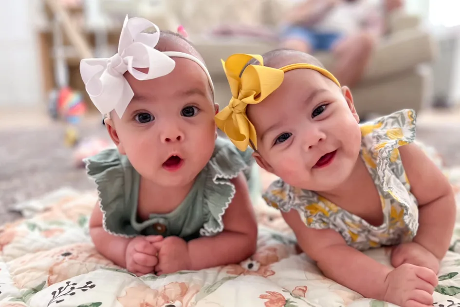 My Sweet Girls Were Born Conjoined - Mum Sandy Fuller explains how her ...