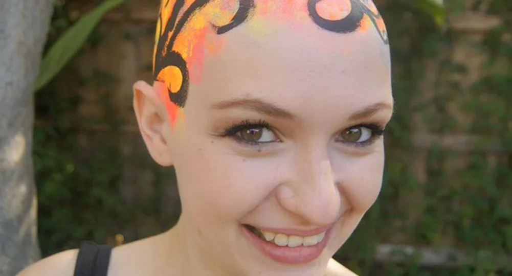 Inspiring Melbourne teen shares what it's like to live with alopecia ...