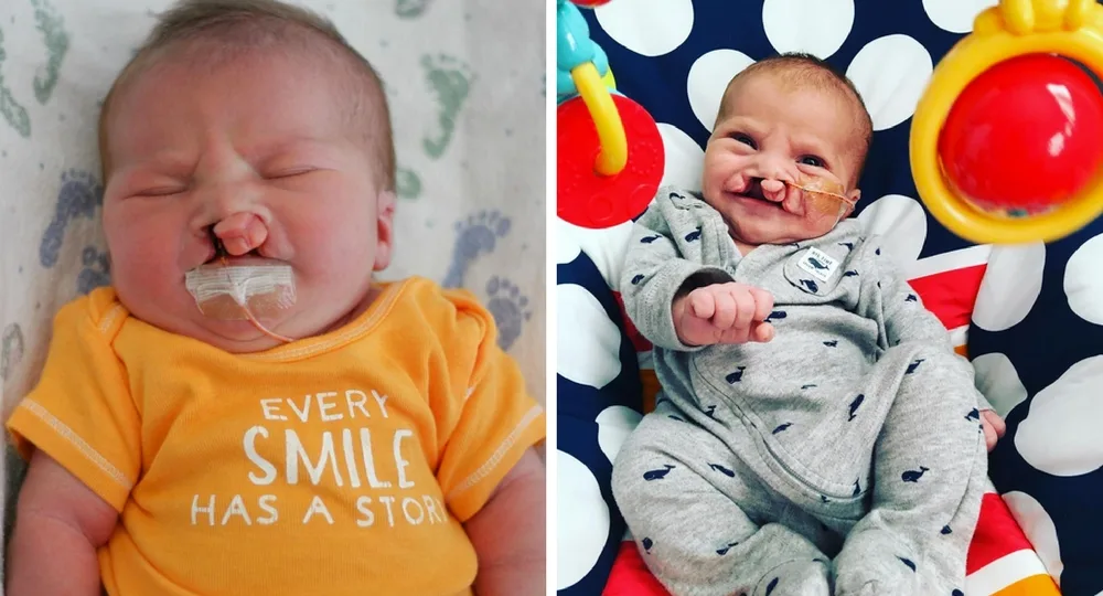 Adorable bub shows off his FOREVER smile | that's life!