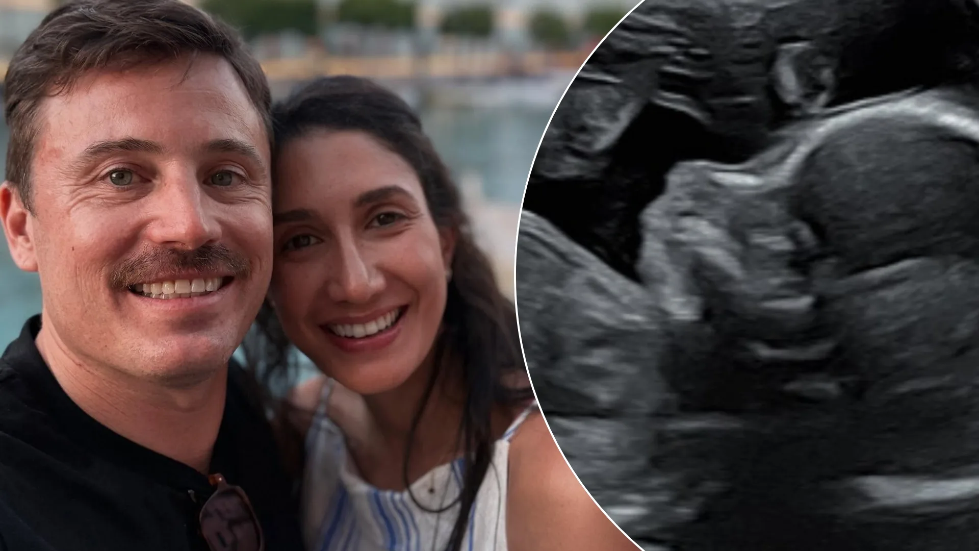 James Tobin and wife Farrah are expecting a baby