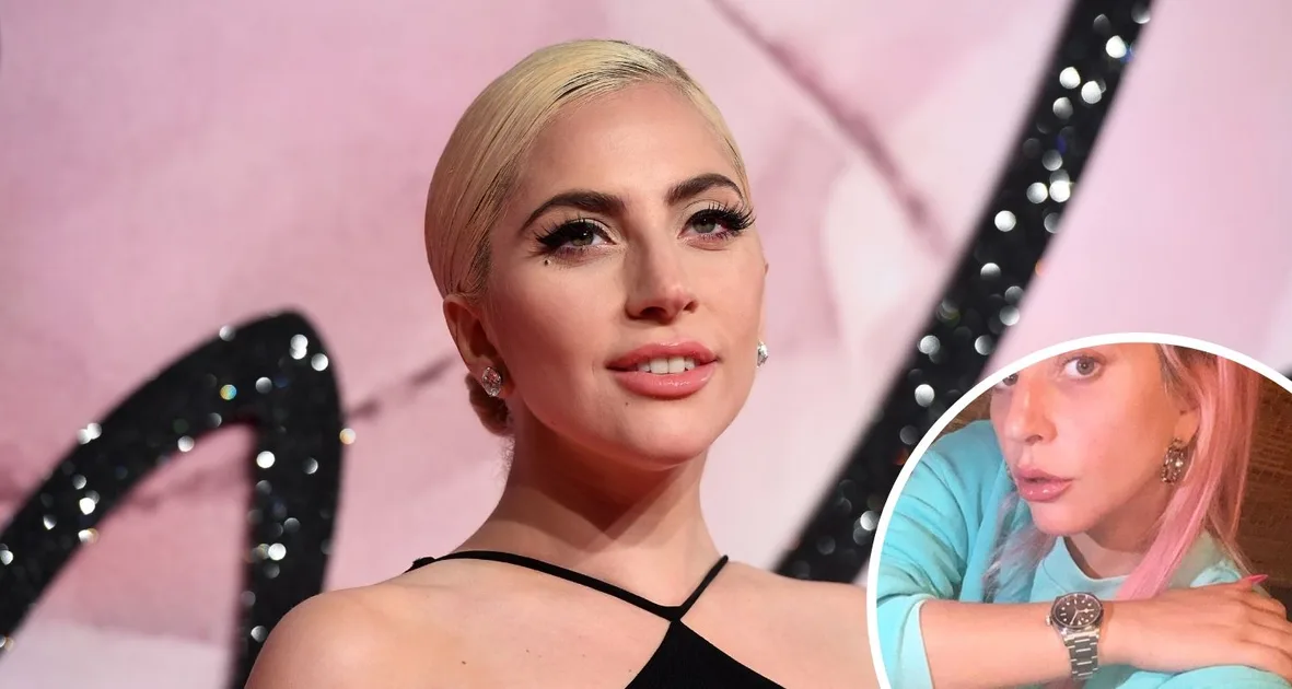 Lady Gaga shows off bizarre new eyebrows | WHO