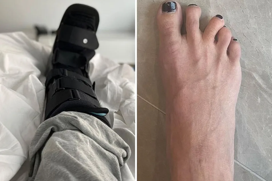 Home and Away Star Esther Anderson’s Horror Injury Leaves Fans Stunned ...