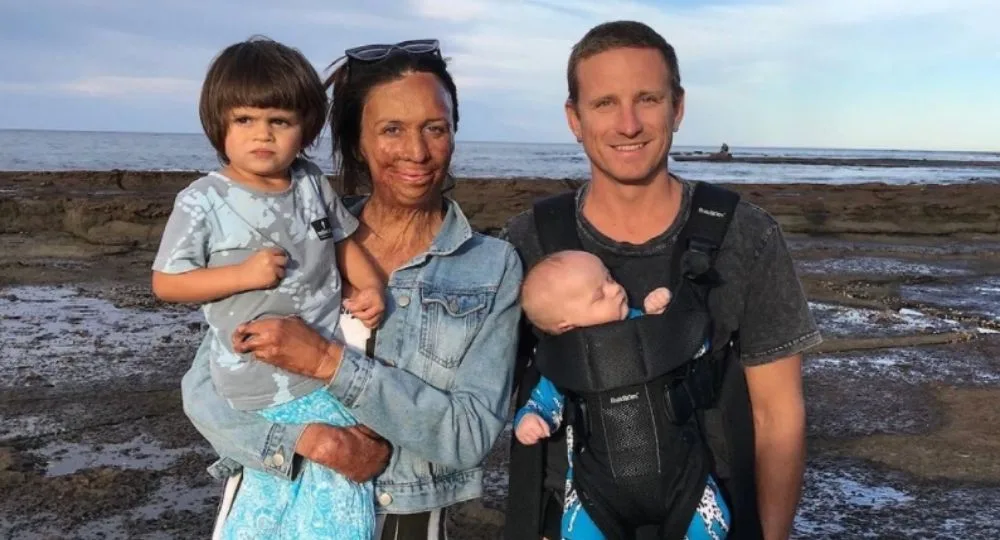 Inside Turia Pitt's busy life with her children | WHO
