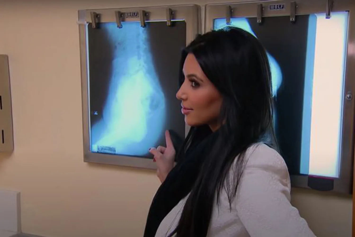Kim Kardashian plastic surgery: The procedures she's confessed to