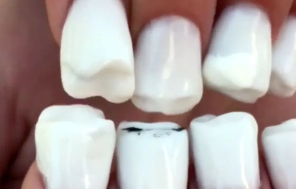 Teeth nail trend | Girlfriend