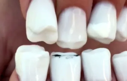 Teeth nail trend | Girlfriend