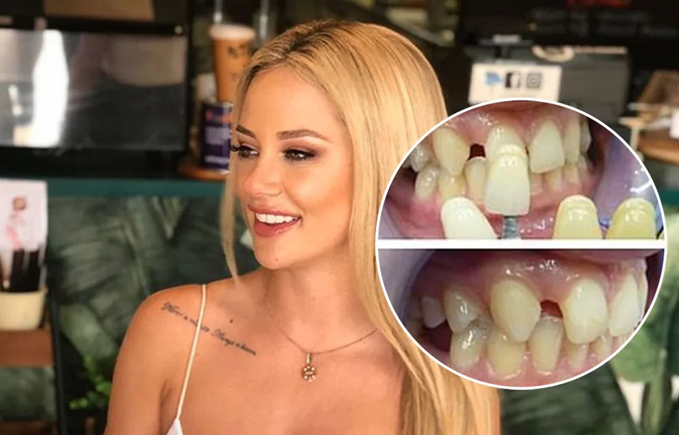 MAFS Jessika extreme dental work | Girlfriend