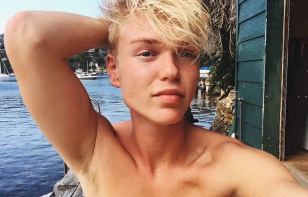 Jack Vidgen Gets Sassy On Twitter In Regards To Those Plastic Surgery ...