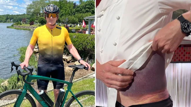 Gordon Ramsay bike accident: What happened? | New Idea