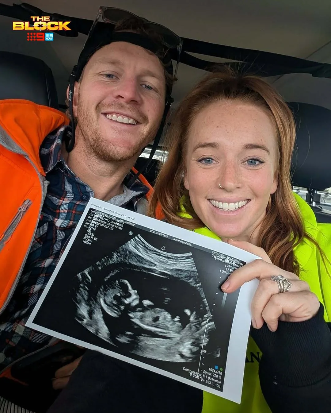 The Block stars Emma and Ben welcome their first child!