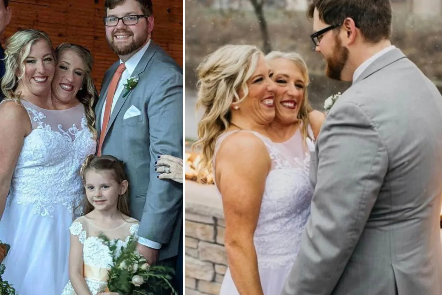 Conjoined Hensel twins appear to confirm baby news | New Idea