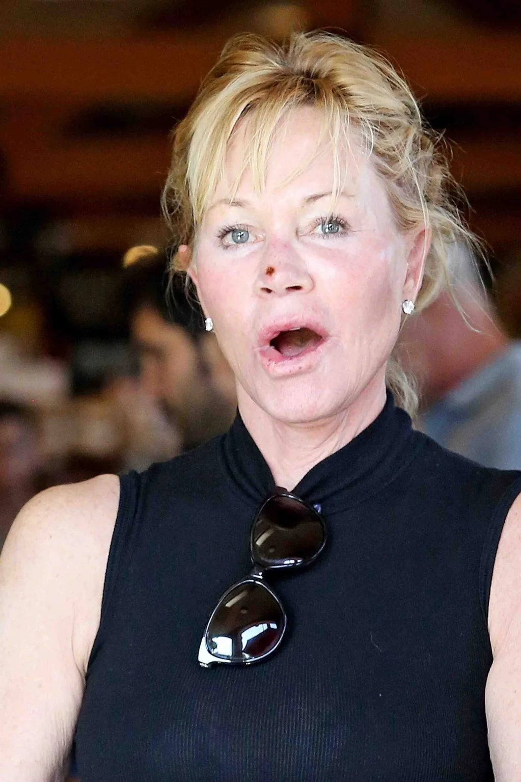 Melanie Griffith rumoured to have skin cancer | New Idea