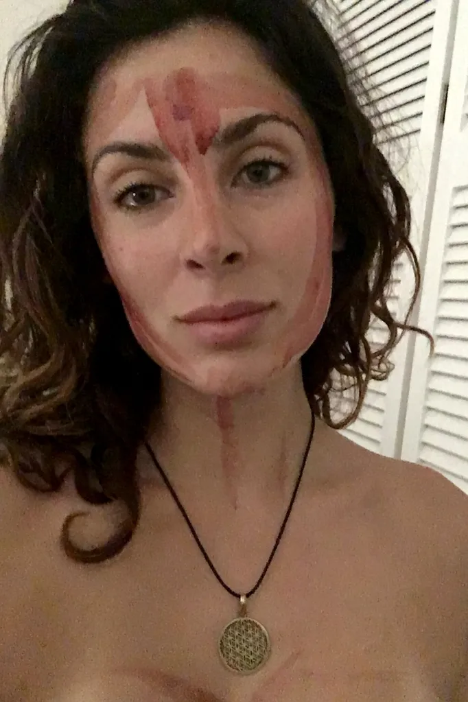 Woman has menstrual blood facial and says she feels better than ever ...