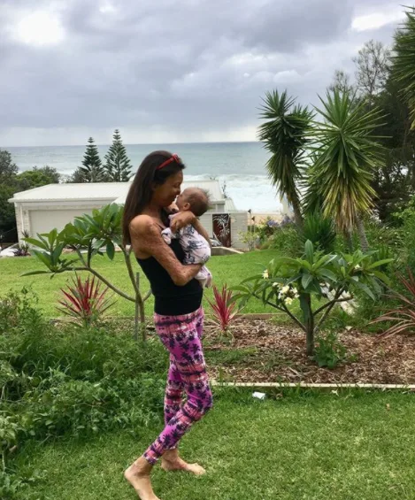 'I lost seven fingers but the life I've created blows me away': Turia ...