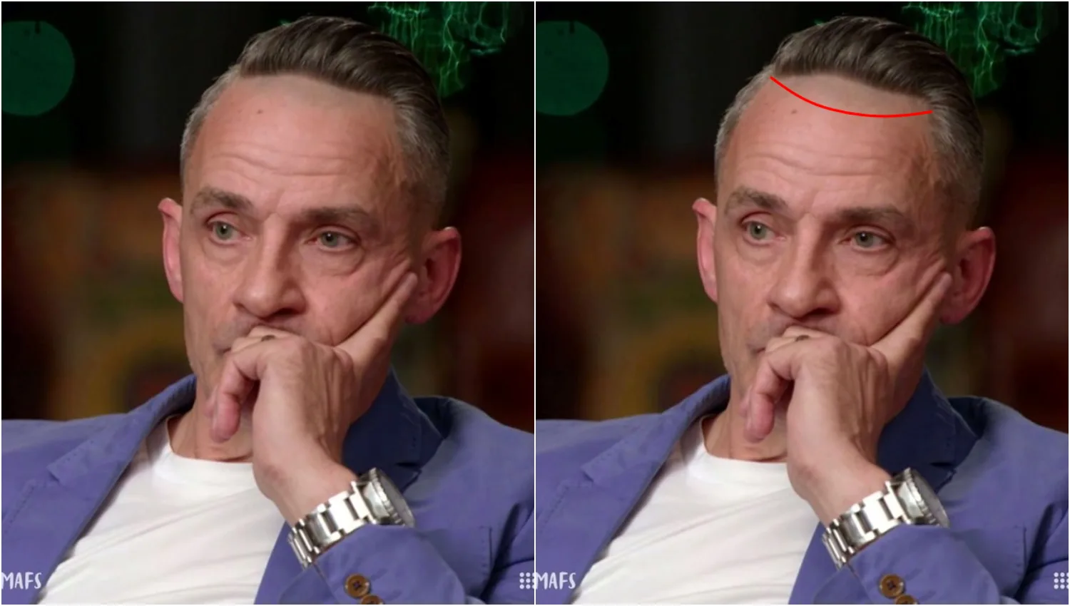 Once you see this detail about Steve Burley's hairline you won't be ...