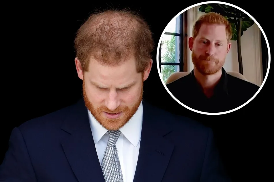 Prince Harry’s new hair plugs! | New Idea