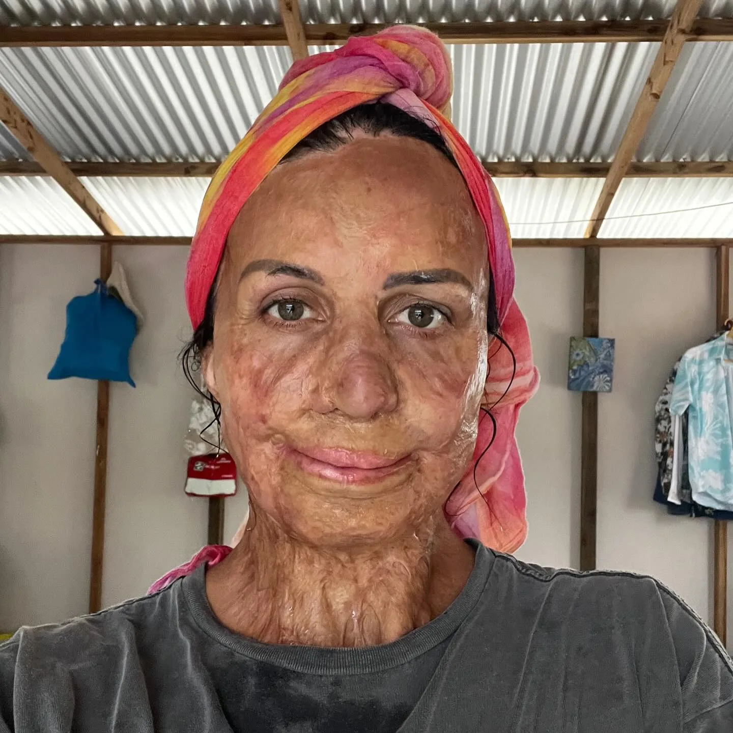 Turia Pitt Aims to Improve Running Safety for Women