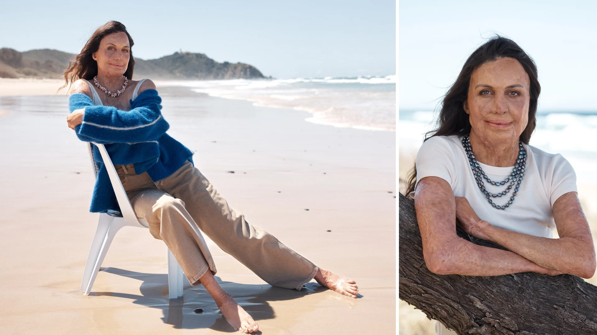 How Turia Pitt finally learned to be selfish - The Australian Women's ...