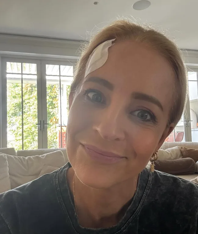 Carrie Bickmore shares an update on painful head injury - The ...