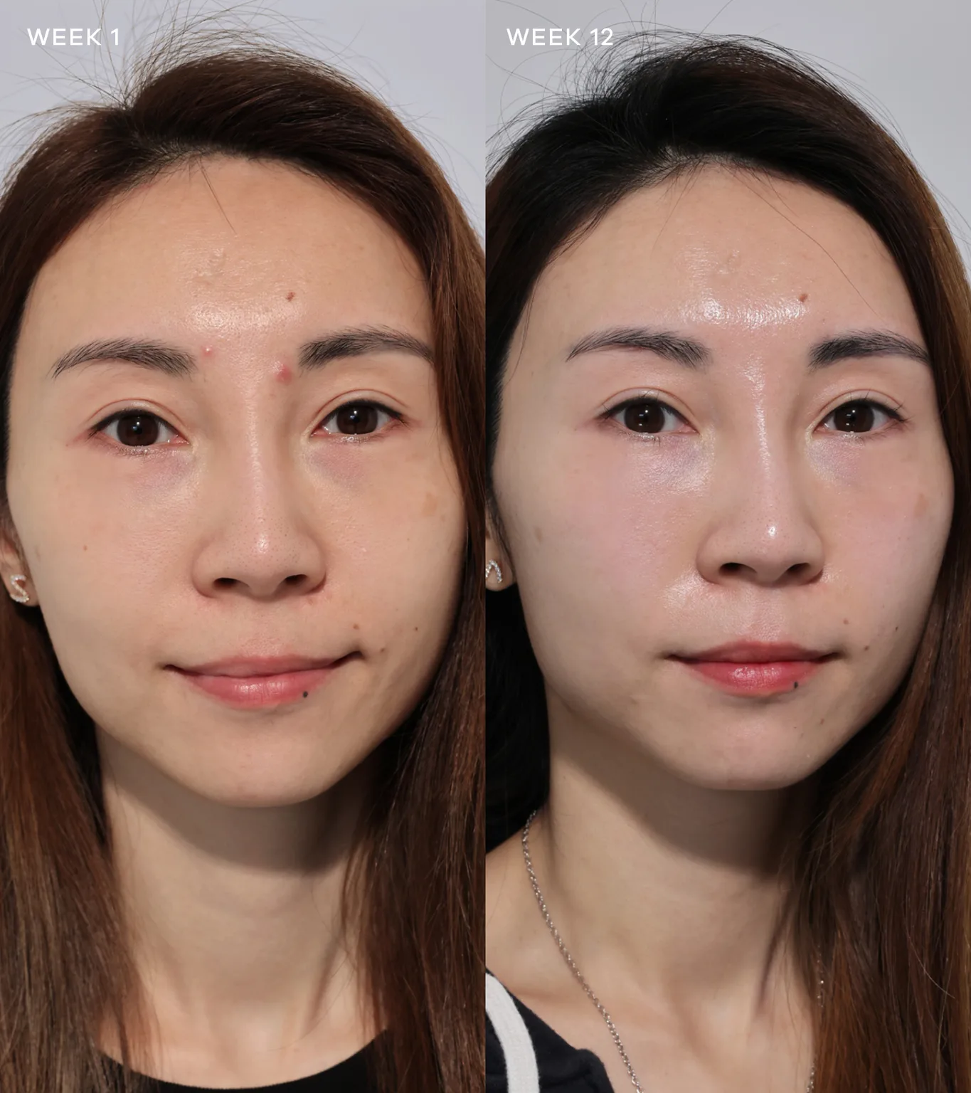Vida Glow’s New Pro Collagen+ Supplement Transforms Skin In 21 Days