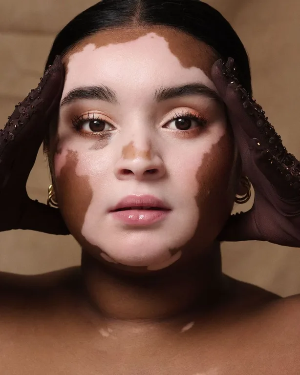 Four Australian Models Whose Careers Started With A Model Search ...