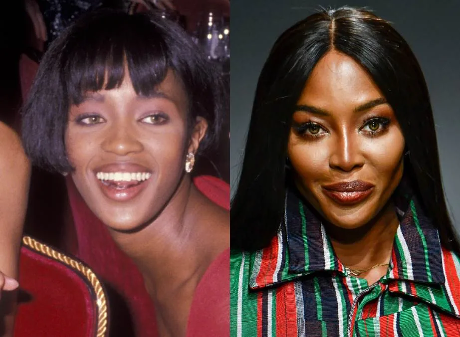 12 Supermodels' Before & After Beauty Transformations