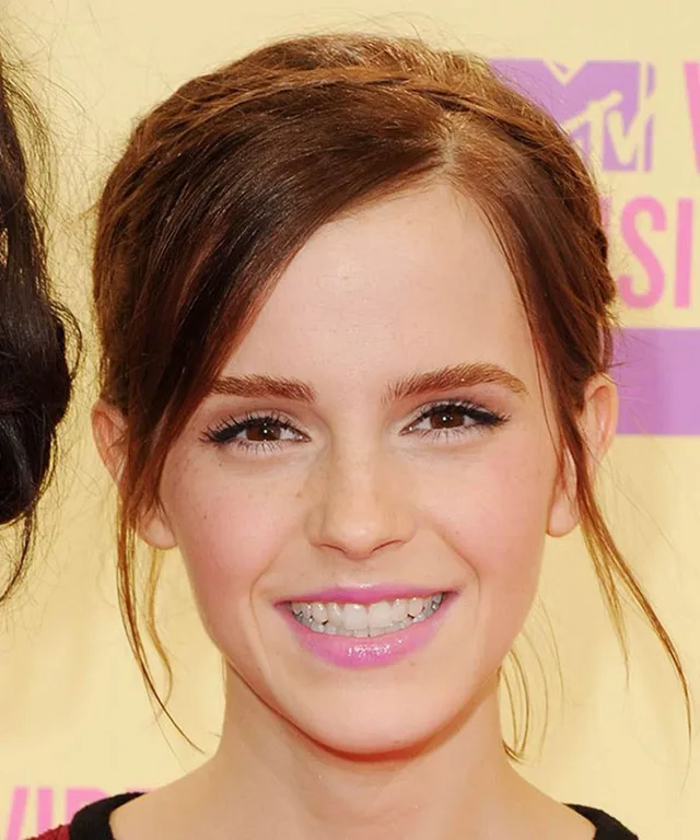 Emma Watson's Before & After Beauty Evolution