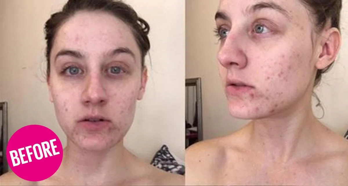 Micellar water before and after store