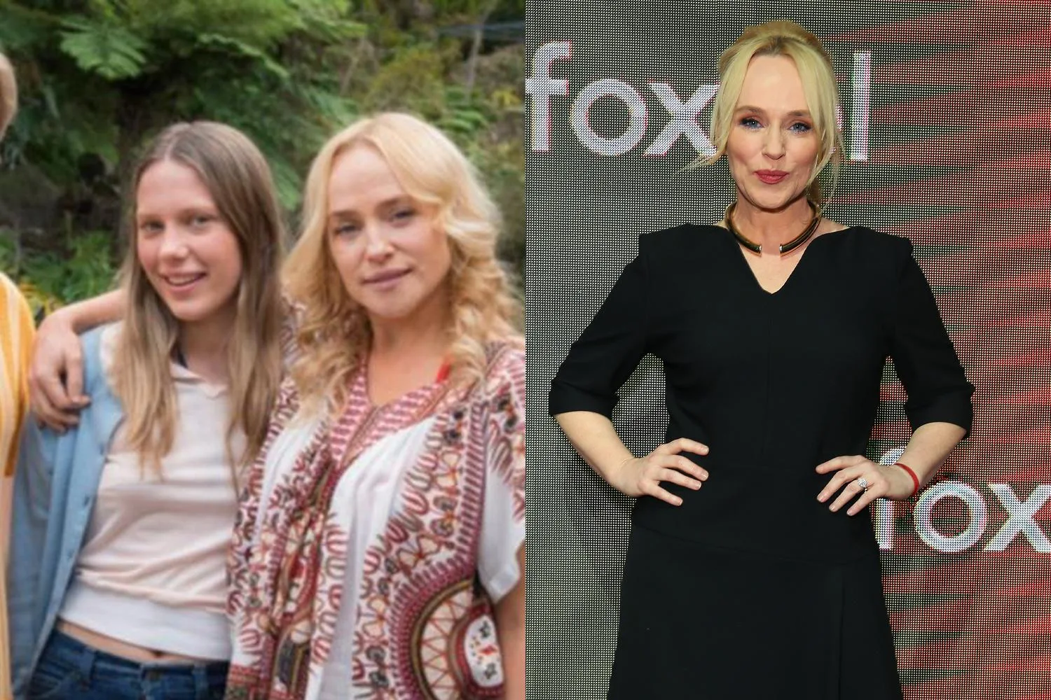 'Puberty Blues' Cast: Where Are The Cast Now?
