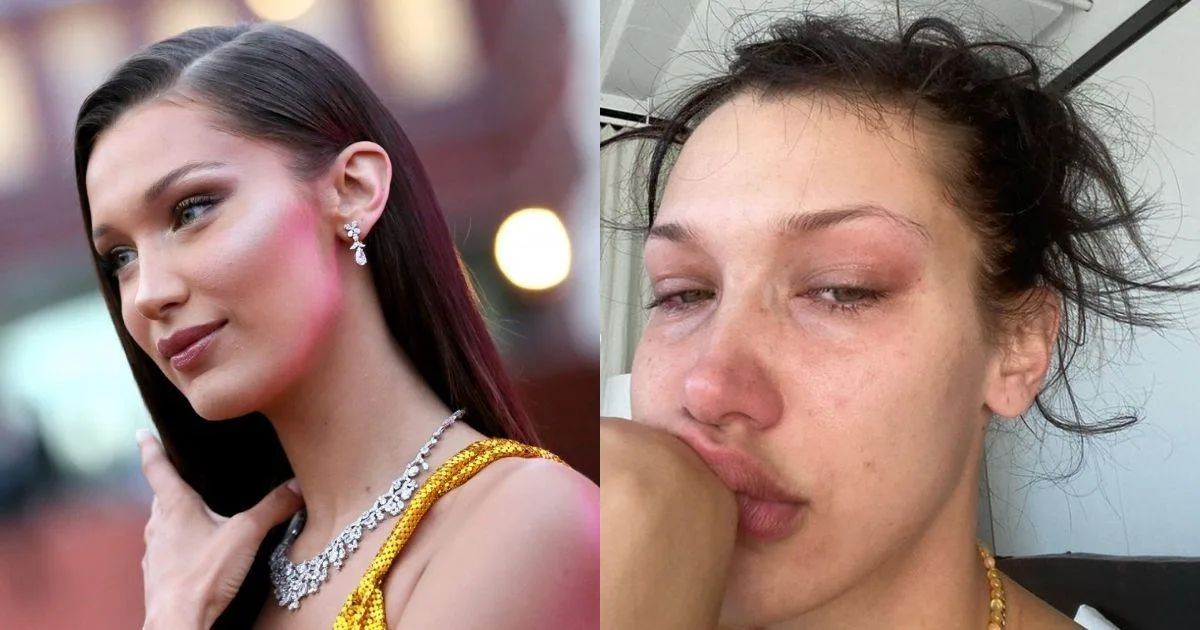 Bella Hadid Celebrates A Major Mental Health Milestone