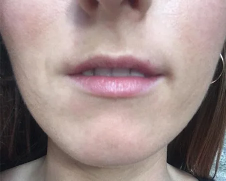 Lip Flip Review: Better Than Lip Filler for Plump Pout? | ELLE
