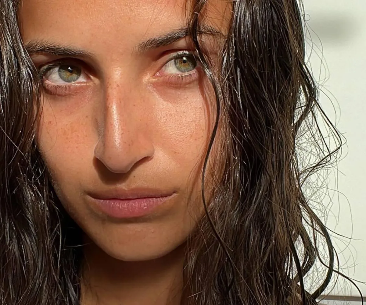 Profhilo: The Injectable Moisturizer Treatment Reviewed | ELLE