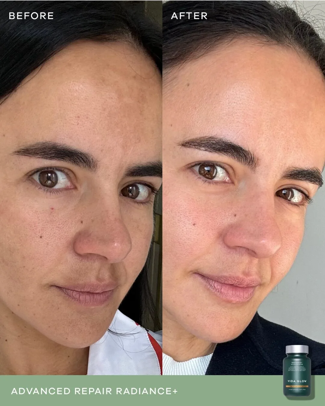 We Tried Vida Glow’s New Radiance Capsules And The Results Are Glowing