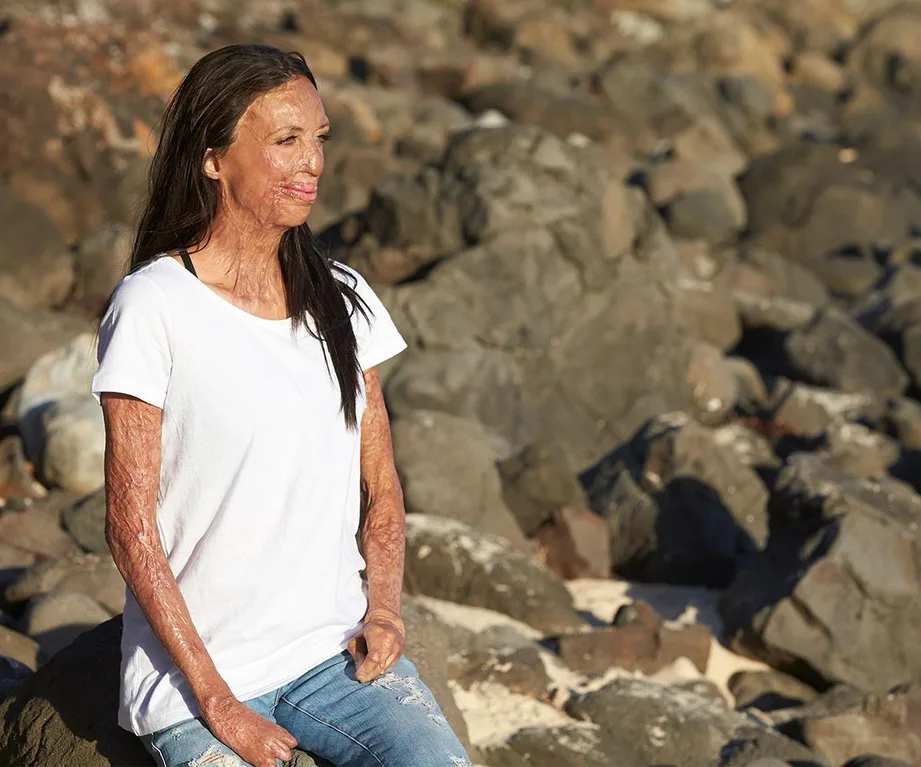 Turia Pitt is Australia's most inspiring woman