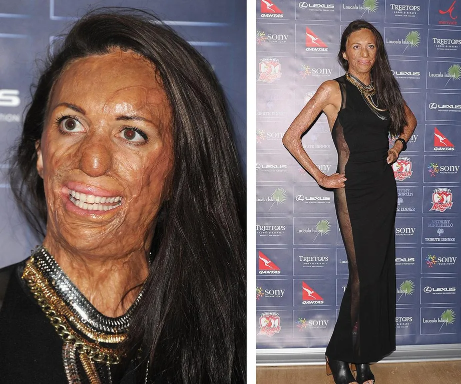 Turia Pitt is Australia's most inspiring woman
