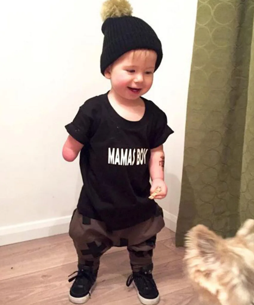Meet the one-armed toddler shaking up Instagram