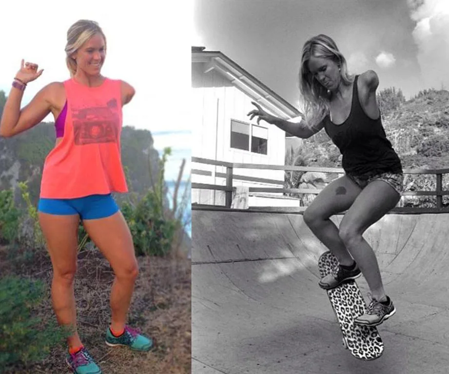 Bethany Hamilton's most inspirational moments