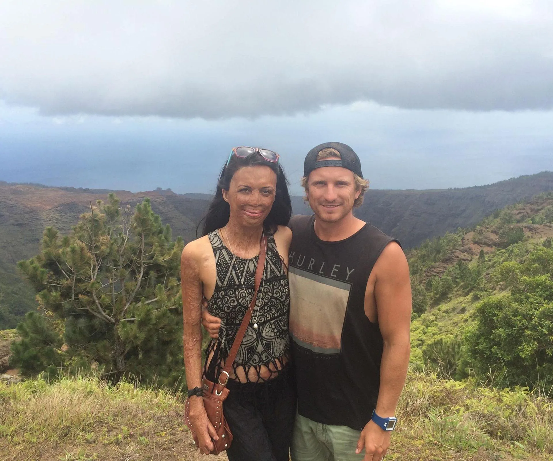 Turia Pitt and Michael Hoskin love story in pictures