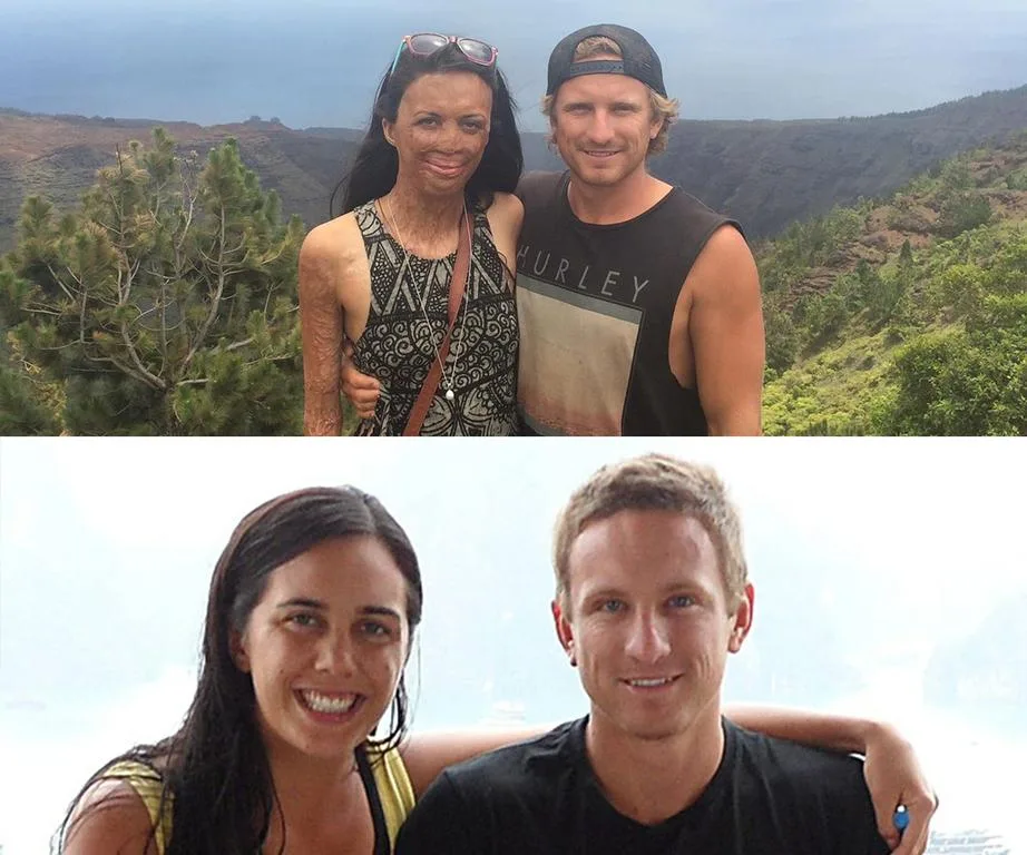 Turia Pitt inspirational moments