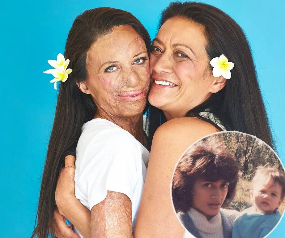 Turia Pitt inspirational moments
